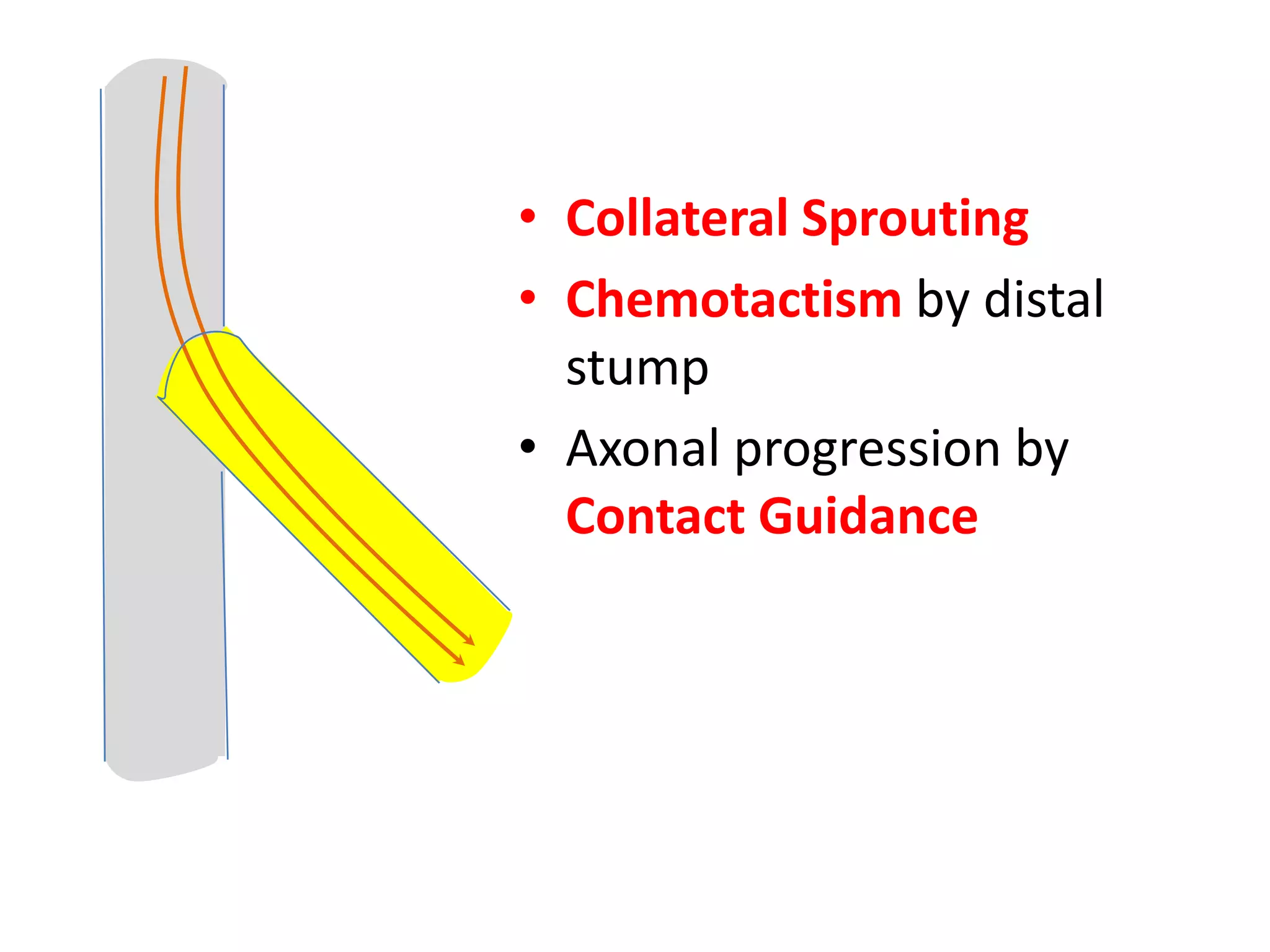 End to side nerve anastomosis & nerve conduits surgical technique ...