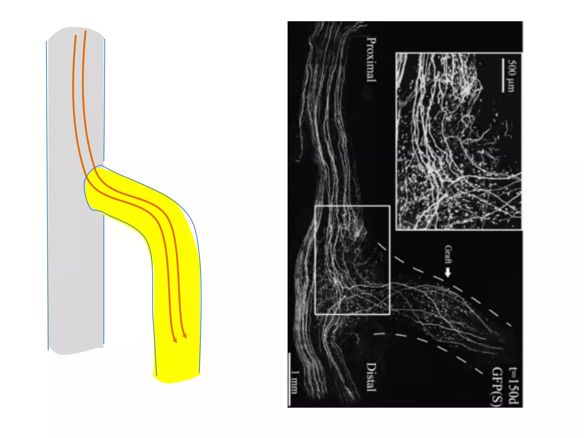End to side nerve anastomosis & nerve conduits surgical technique attikon 2013 | PPTX
