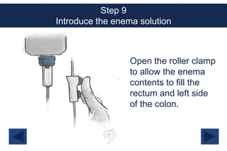 Enema Administration and procedure lecture | PDF