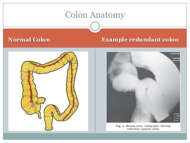 Enema – when the prep didn’t work!