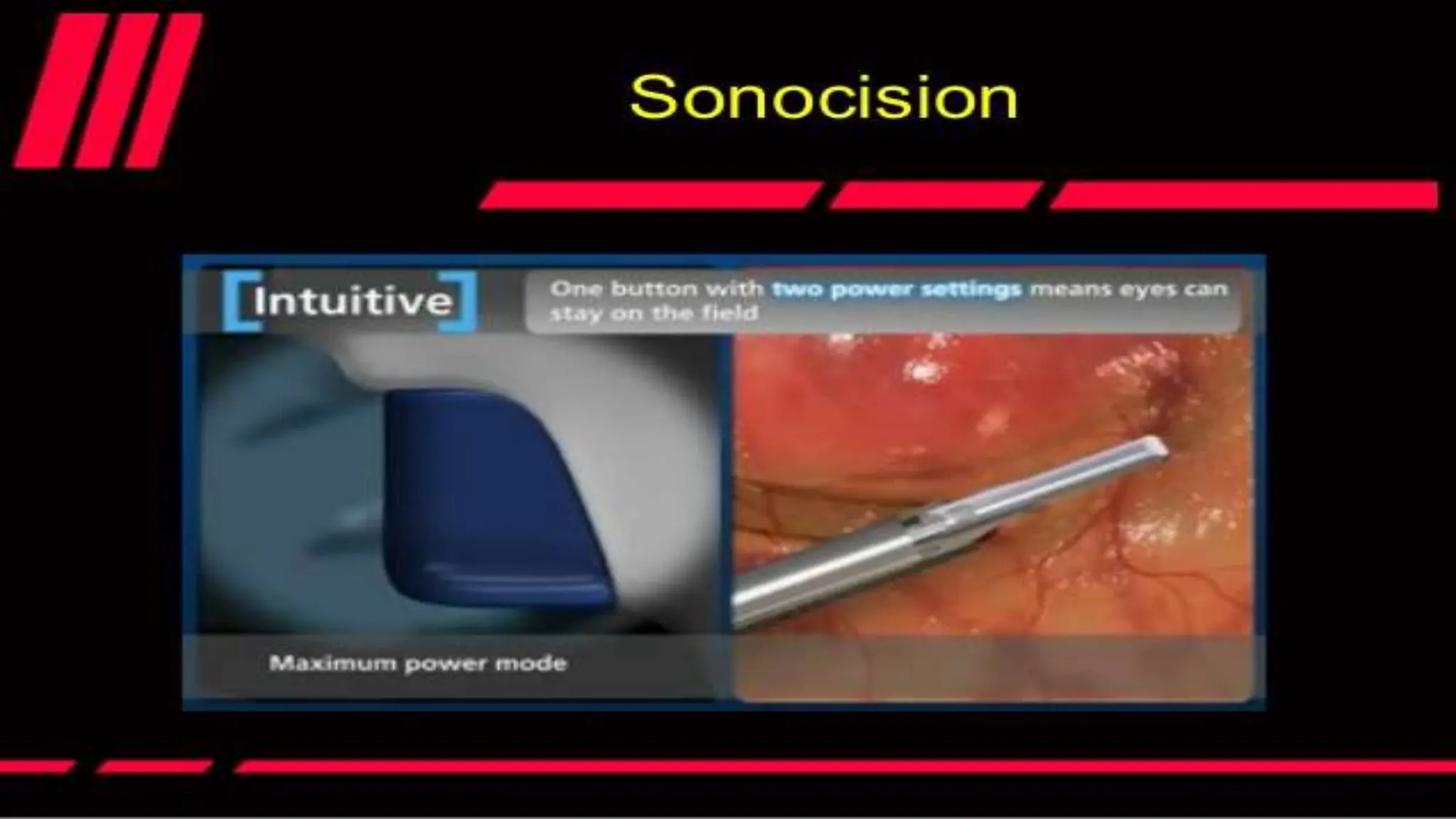 Energy source used in laparoscopic surgery(1) (1).pptx