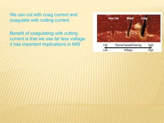 Energy devices in surgery | PPTX