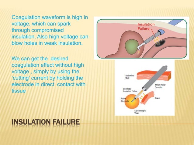 Energy devices in surgery | PPTX