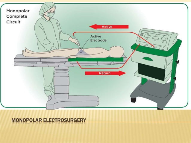 Energy devices in surgery | PPTX