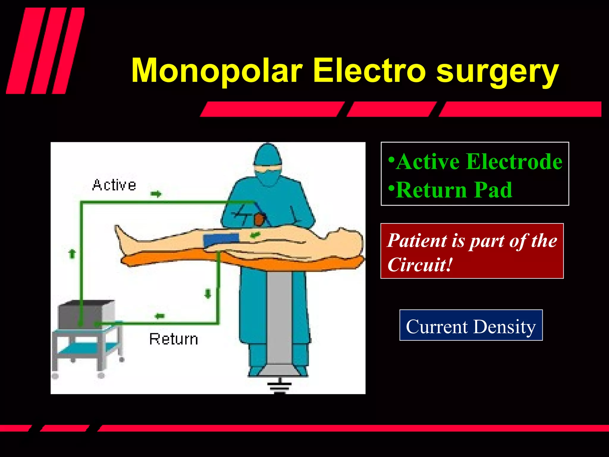 Energy sources for laparoscopic surgery | PPT