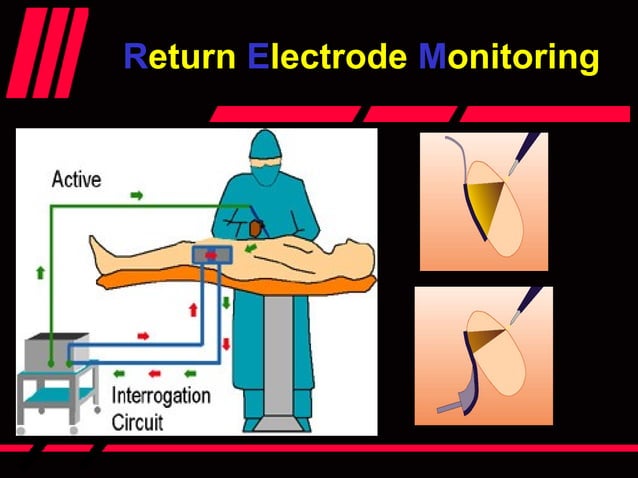 Energy sources for laparoscopic surgery | PPT