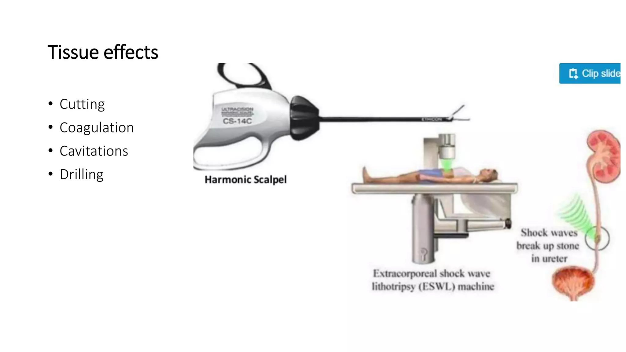 Energy sources in surgery | PPTX