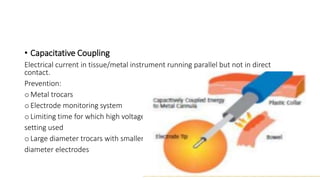 Energy sources in surgery | PPTX