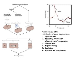 Energy sources in urology | PPTX