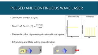 Lasers: Energy sources in urology (part 1) | PPTX