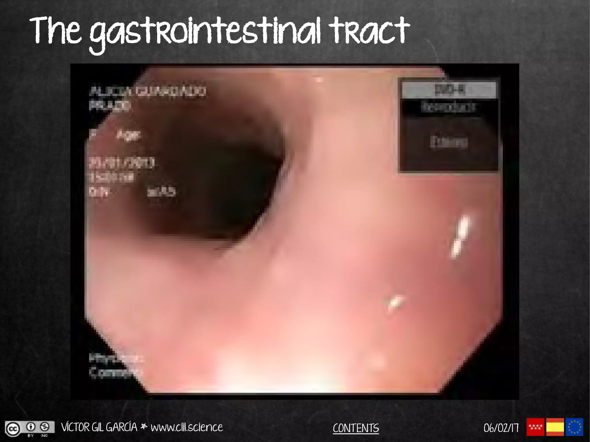 The Digestive System - Anatomy and Physiology - Biology and Geology 3rd ...