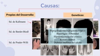 Enfermedades de la Glandula Hipofisis .pptx