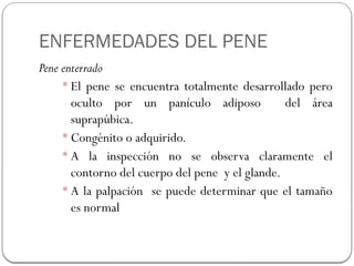 enfermedad de los genitales externos urología | PPTX