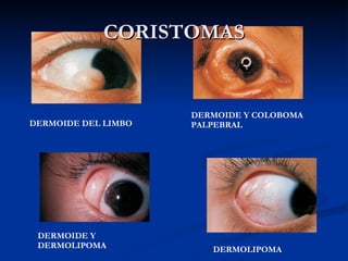Enfe Externas Del Ojo | PPT
