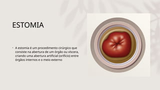 Enfermagem no manejo e cuidados com estomias.pptx