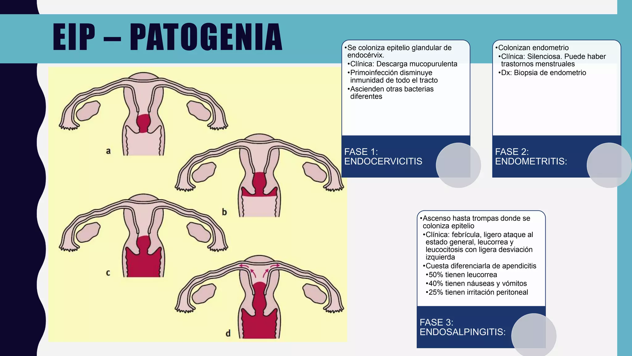 Enfermdad inflamatoria pelvica (eip) | PPTX