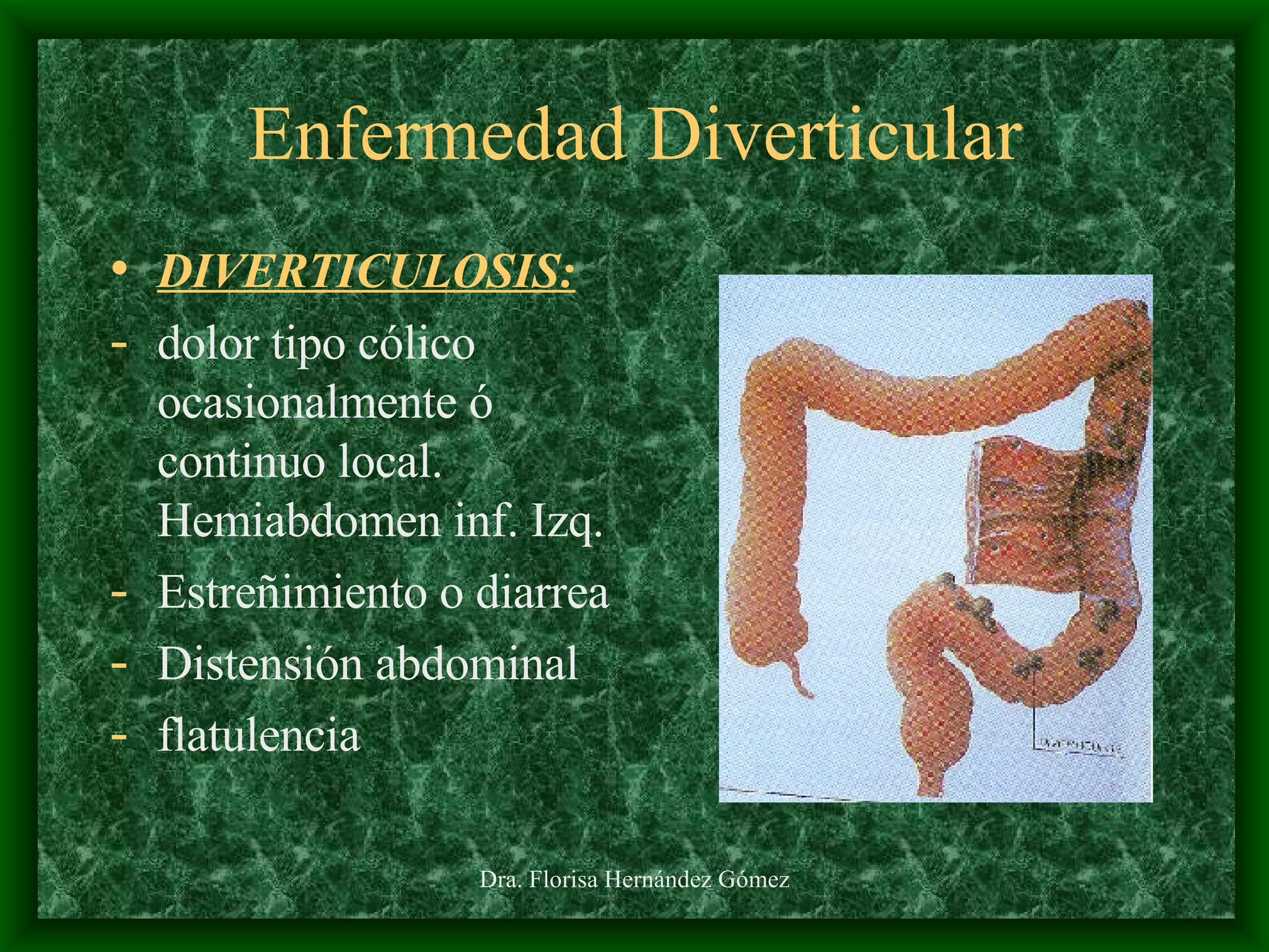 Enfermedad Diverticular Ppt