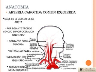 Enfermedad Carotidea | PPT