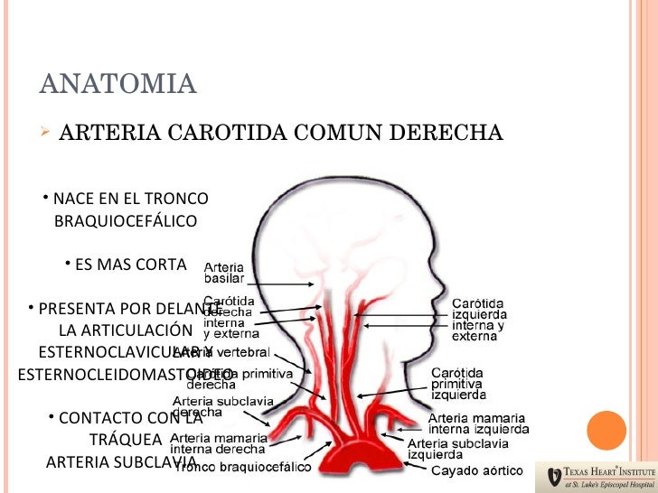 Enfermedad Carotidea