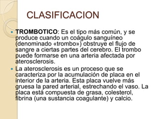 Enfermedad cerebro vascular | PPTX