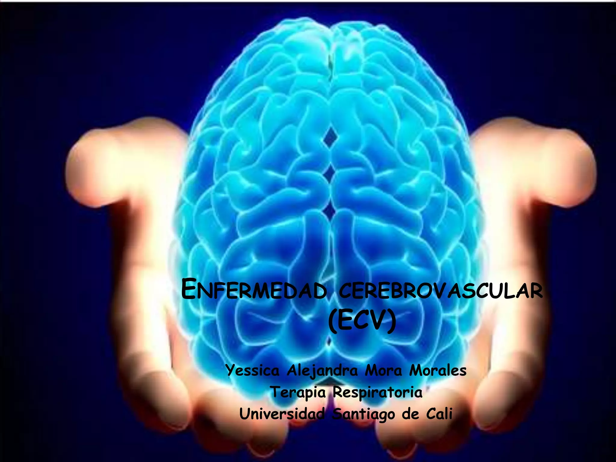 Enfermedad cerebrovascular | PPTX