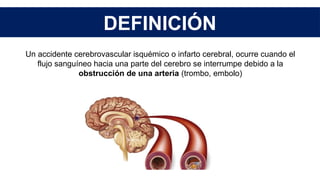 ENFERMEDAD CEREBROVASCULAR ISQUEMICA.pptx