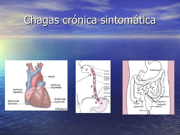ENFERMEDAD DE CHAGAS