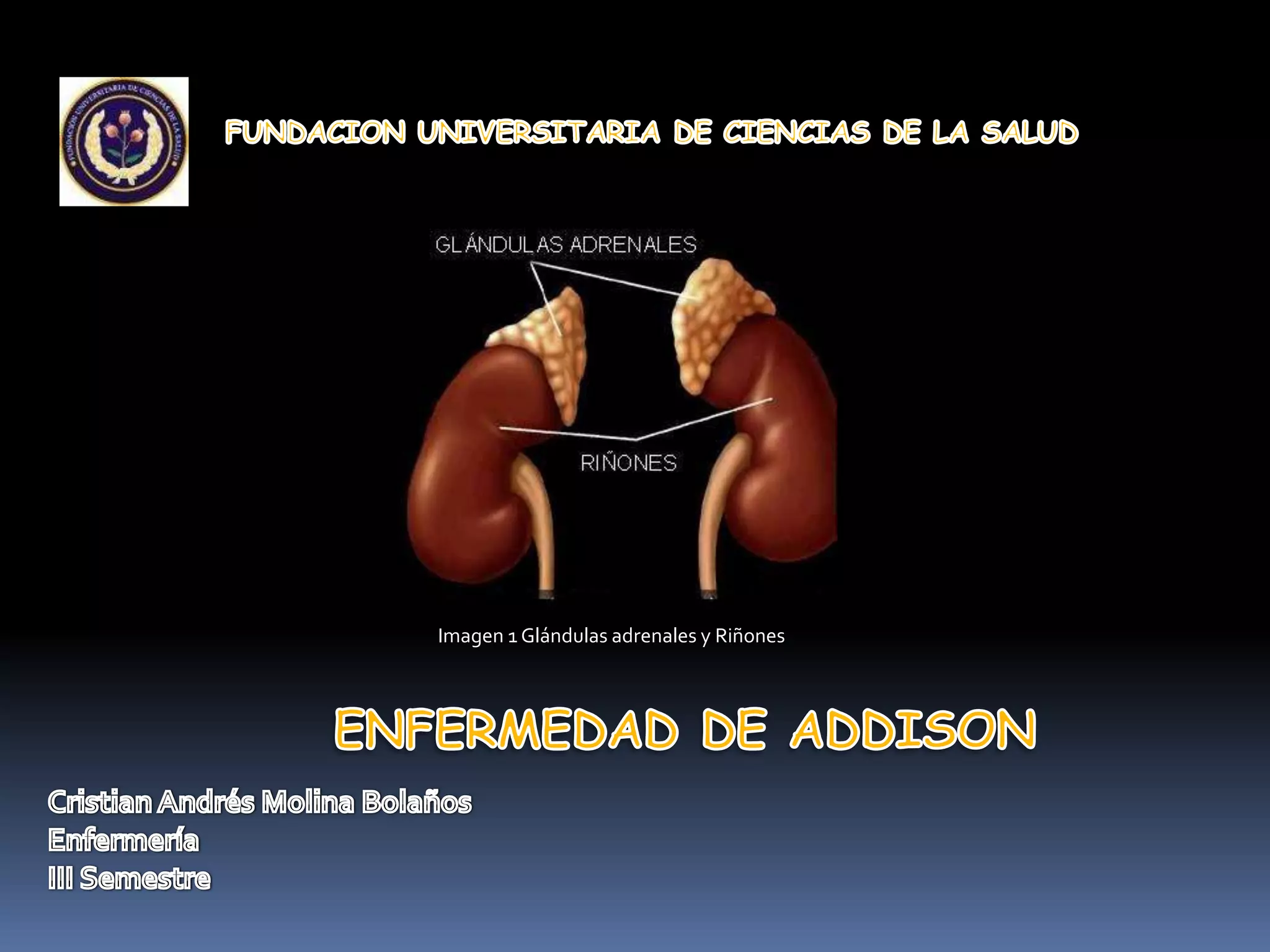 Enfermedad de addison | PPTX