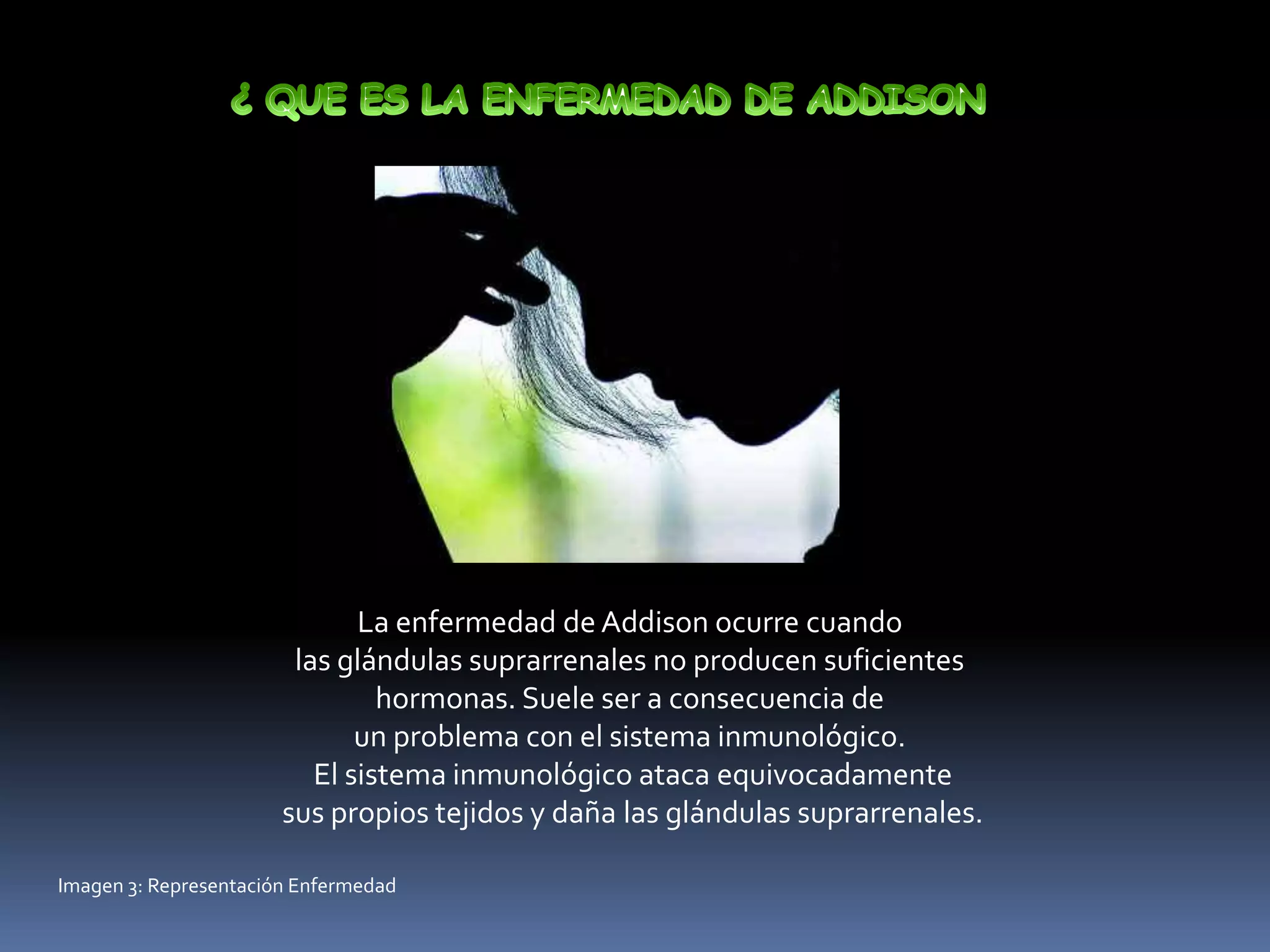 Enfermedad de addison | PPTX