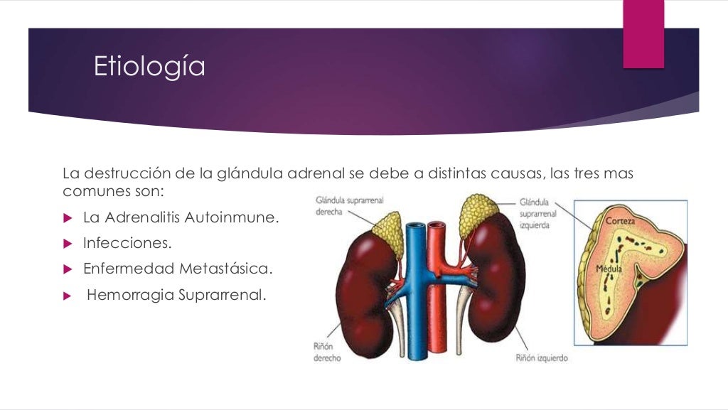 Enfermedad de Addison
