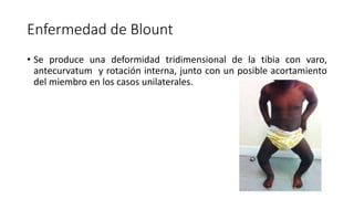ENFERMEDAD DE BLOUNT O TIBIA VARA .pptx
