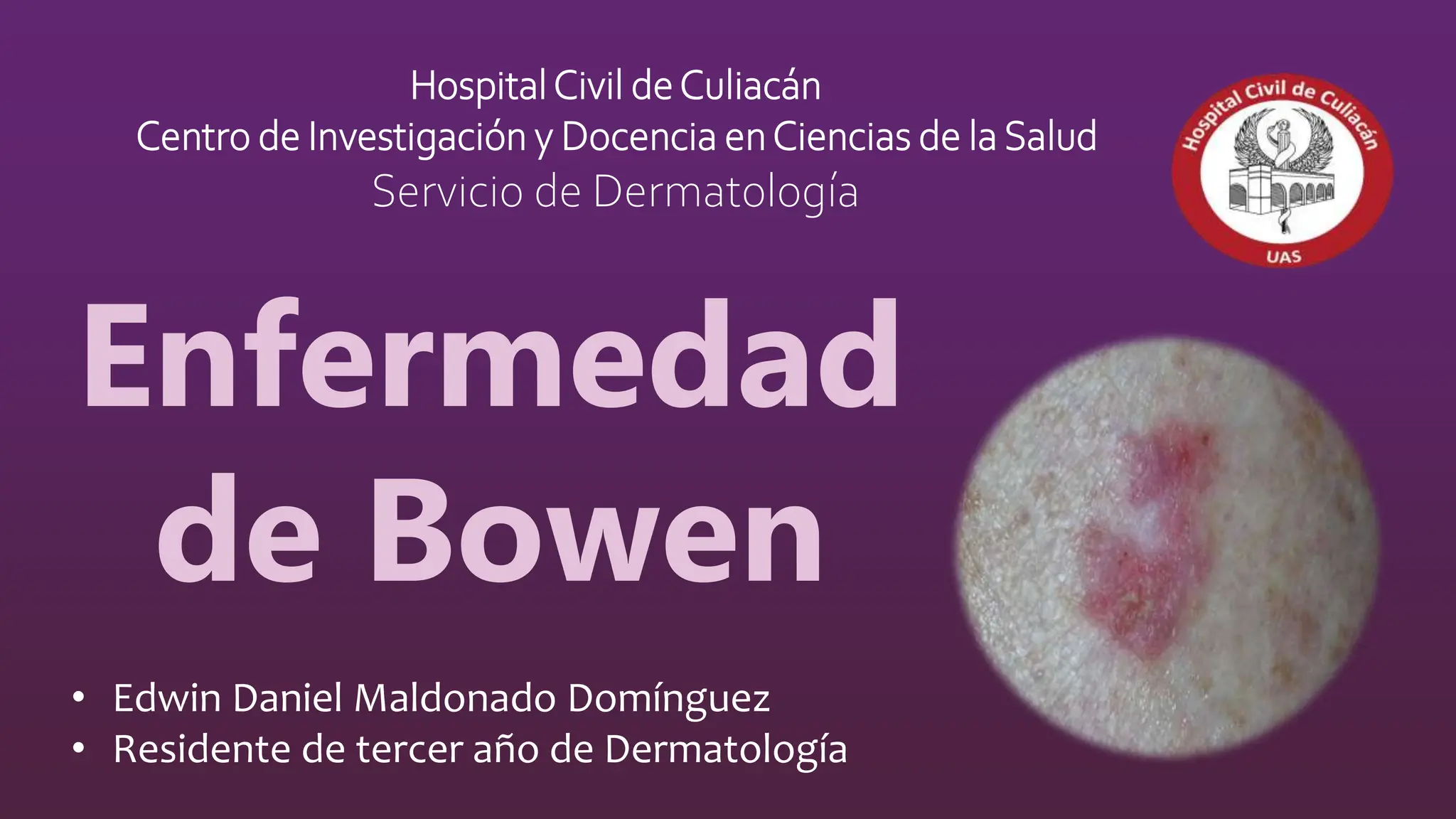 Enfermedad de Bowen | PPTX