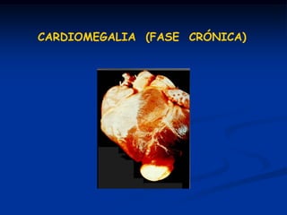 Enfermedad de chagas | PPT
