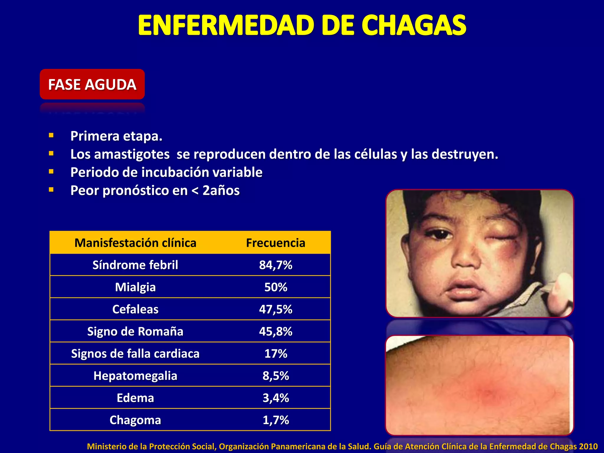Enfermedad de chagas pediatria