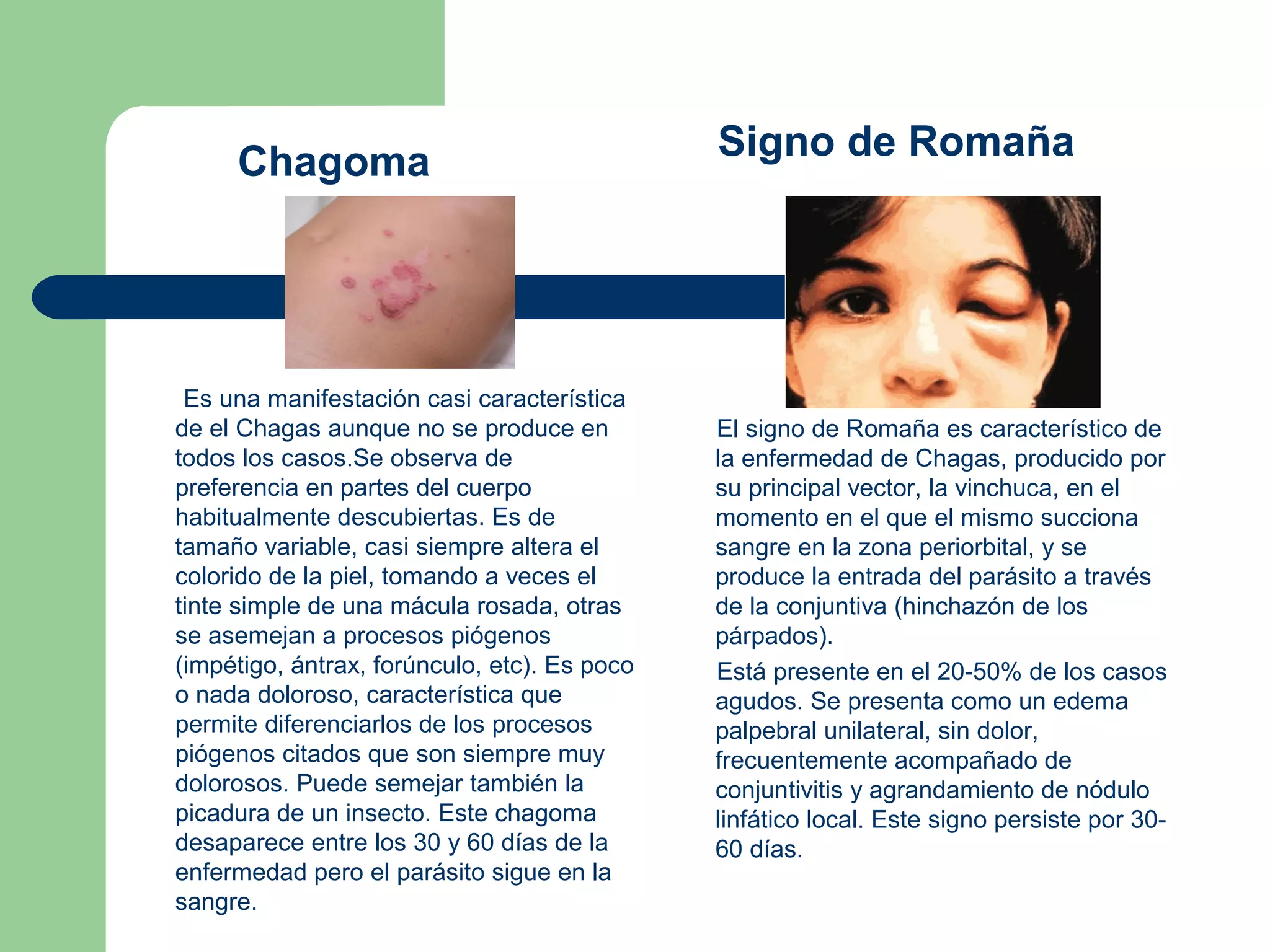 Enfermedad de chagas | PPT