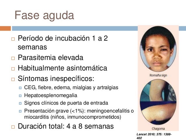 Enfermedad de Chagas para el Médico Internista