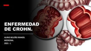 Enfermedad de crohn | PPTX