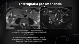 Enfermedad de Crohn y CUCI (colitis ulcerativa cronica inespecifica).pptx