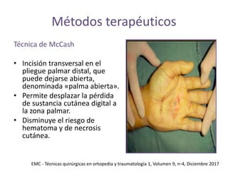 Enfermedad de Dupuytren.pptx