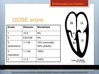 Enfermedad de Ebstein Atresia Tricuspidea Tronco Arterial Comun | PPT