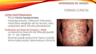 Enfermedad de Hansen | PPTX