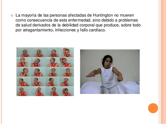 Enfermedad de huntington o corea