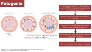 Enfermedad de Kawasaki- Carranza Herrera Valeria | PDF