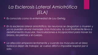 Enfermedad de la neurona motora | PPT