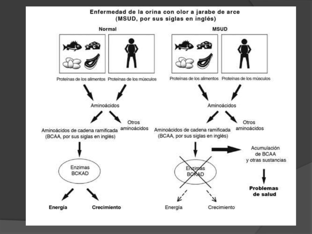 Enfermedad de la orina con olor a Jarabe de Arce(MSUD) o Leucinosis