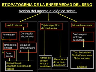 Enfermedad del nodo sinusal enfermo (snse) | PPT