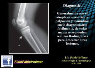 Enfermedad de Osgood-Schlatter pablo vollmar.PDF
