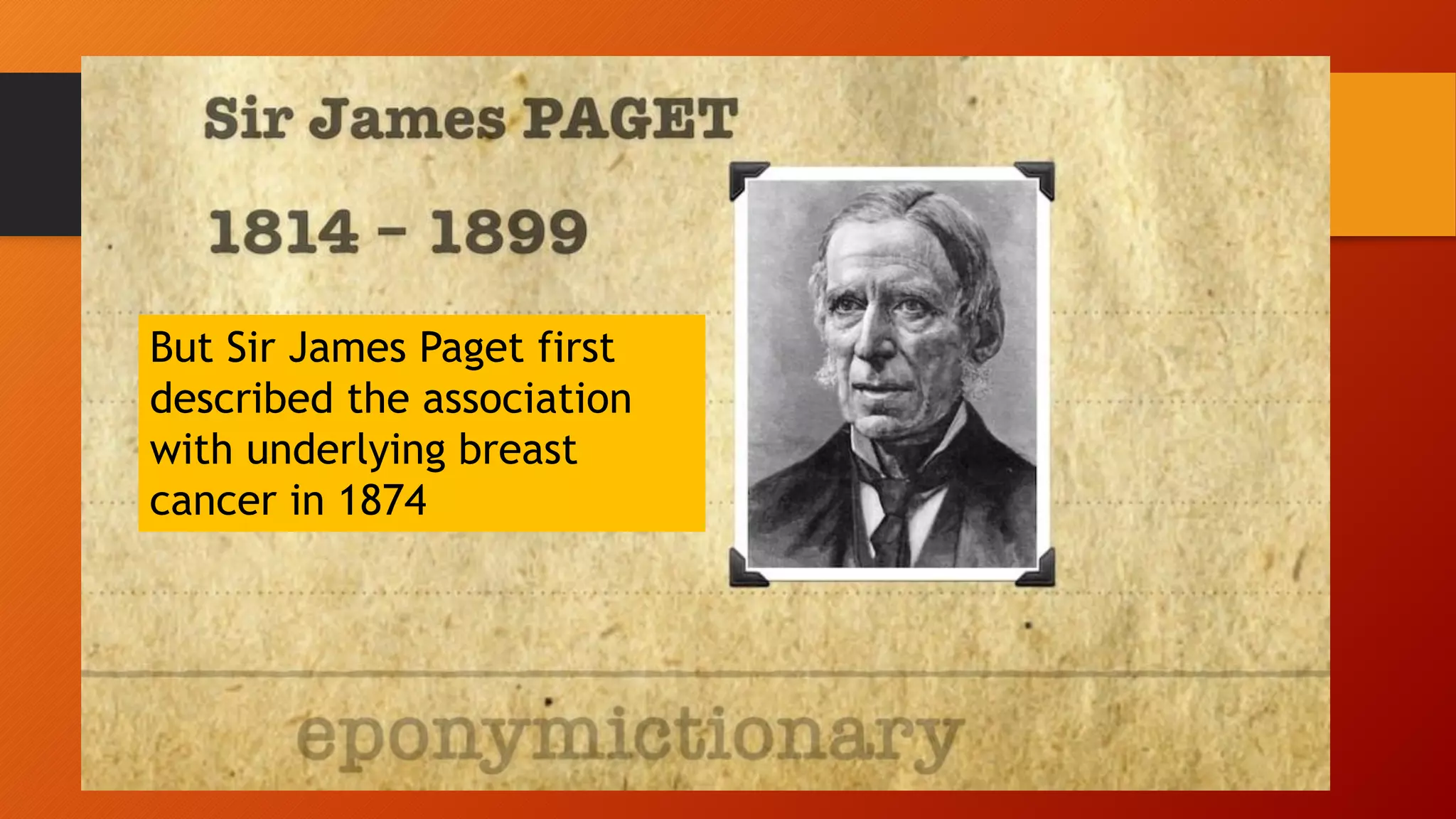 Enfermedad de paget | PPT