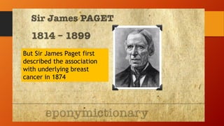 Enfermedad de paget | PDF