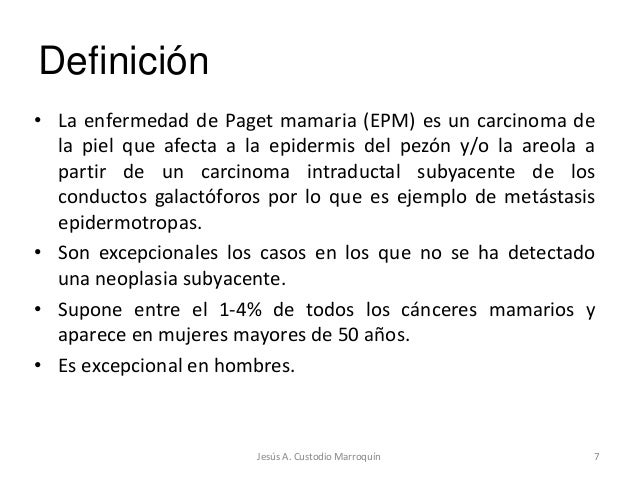 Enfermedad De Paget Del Pezon